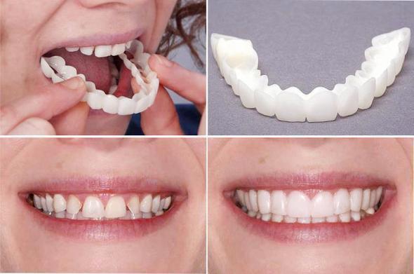 Clip on|Press On Veneers Kit at Home Do It Yourself. – The White Bright