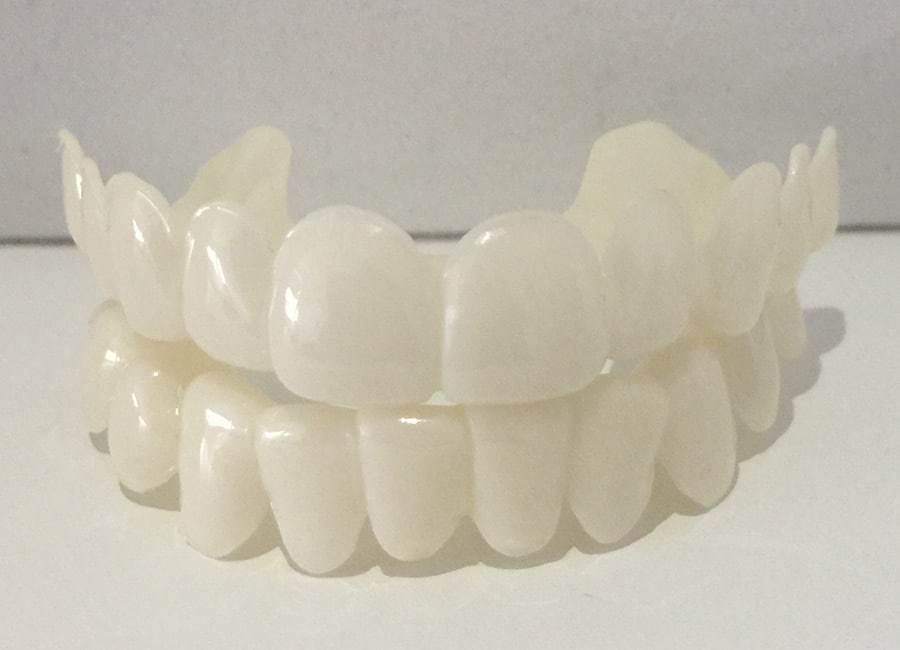 Snap on smile veneers – The White Bright